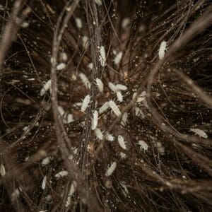 Comment savoir si on a des poux ? Détection 100% fiable et vérifiée